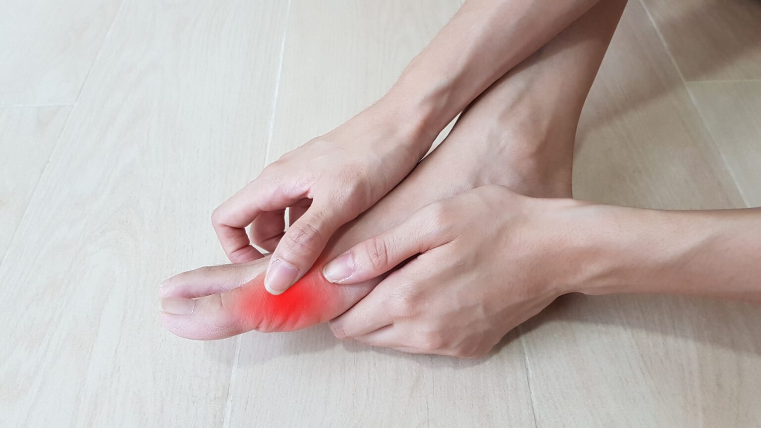 Hallux Valgus, a common foot deformity. - Vanni Strigelli