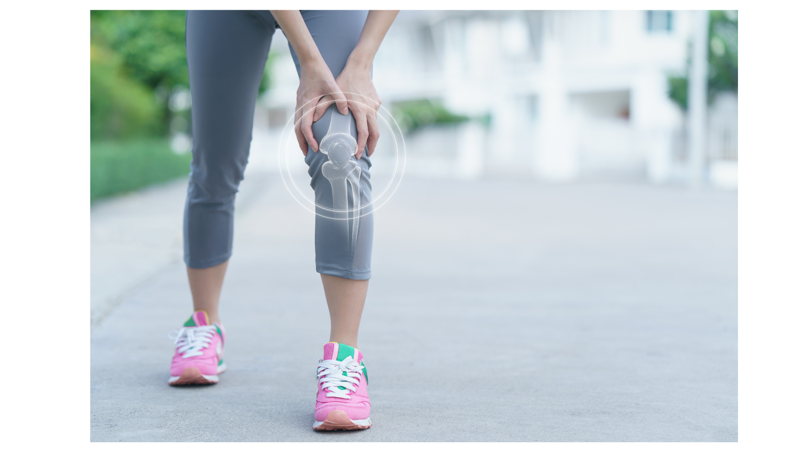 Condropatia femoro-rotulea, un approfondimento - Vanni Strigelli