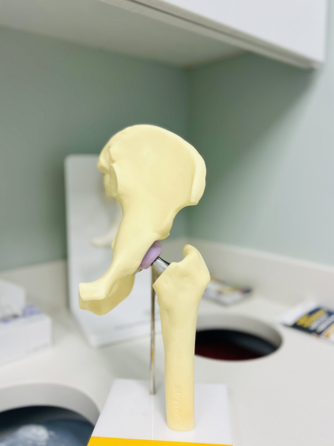 Protesi Anca Immagini: Guida Completa a Procedure e Recupero - Vanni ...